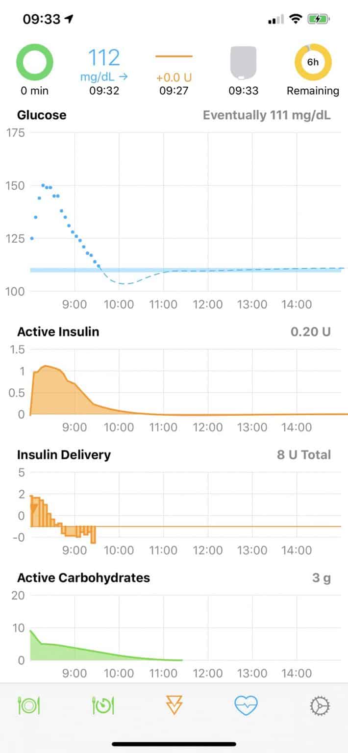 DIY Looping: Building Your Own Closed Loop System - Diabetes Strong