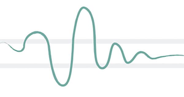 How to Use "Time In Range" to Improve Your Diabetes Management ...