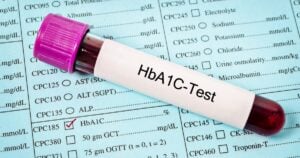 How to Lower Your A1c: The Complete Guide - Diabetes Strong