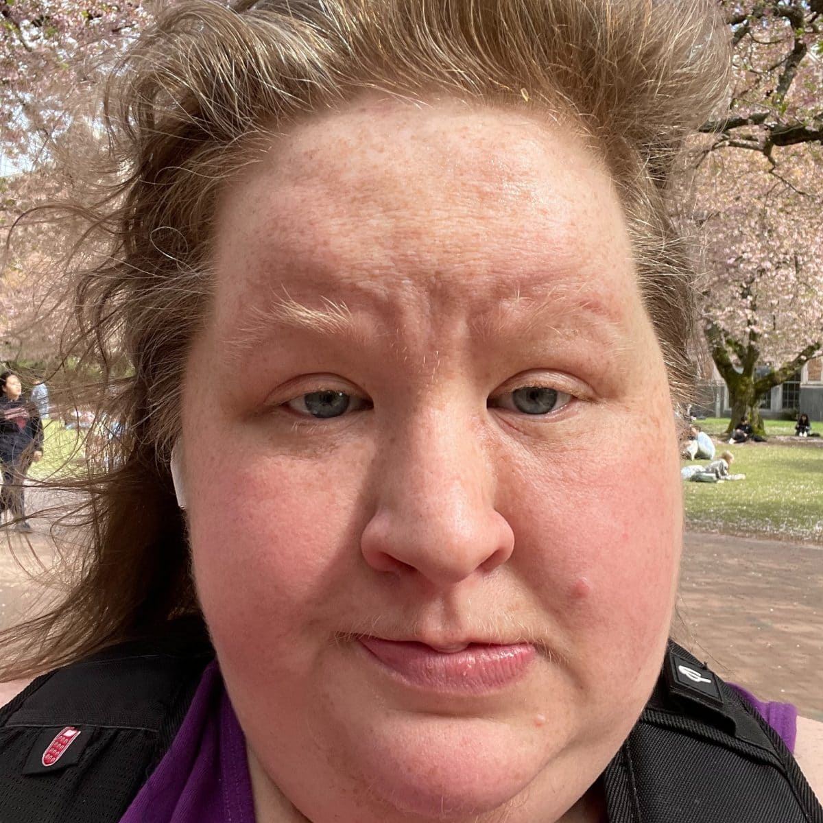 Type 1 Diabetes - Diabetes Strong